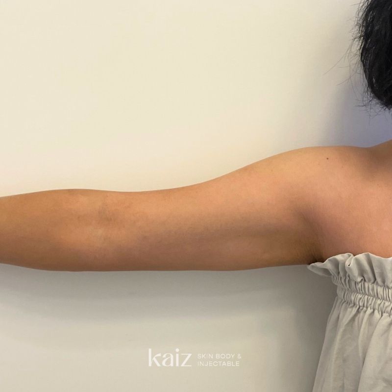 Kaiz Wellness Medispa | Advanced Aesthetics, Parnell Auckland